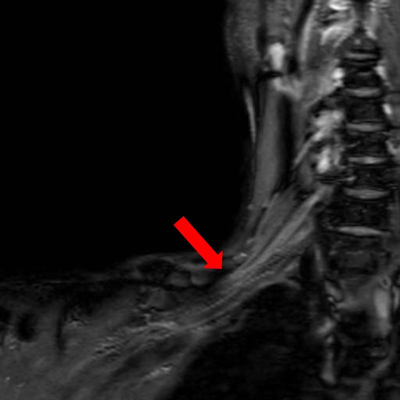 MRI FID reduction | tsuyoshi-oshita.com