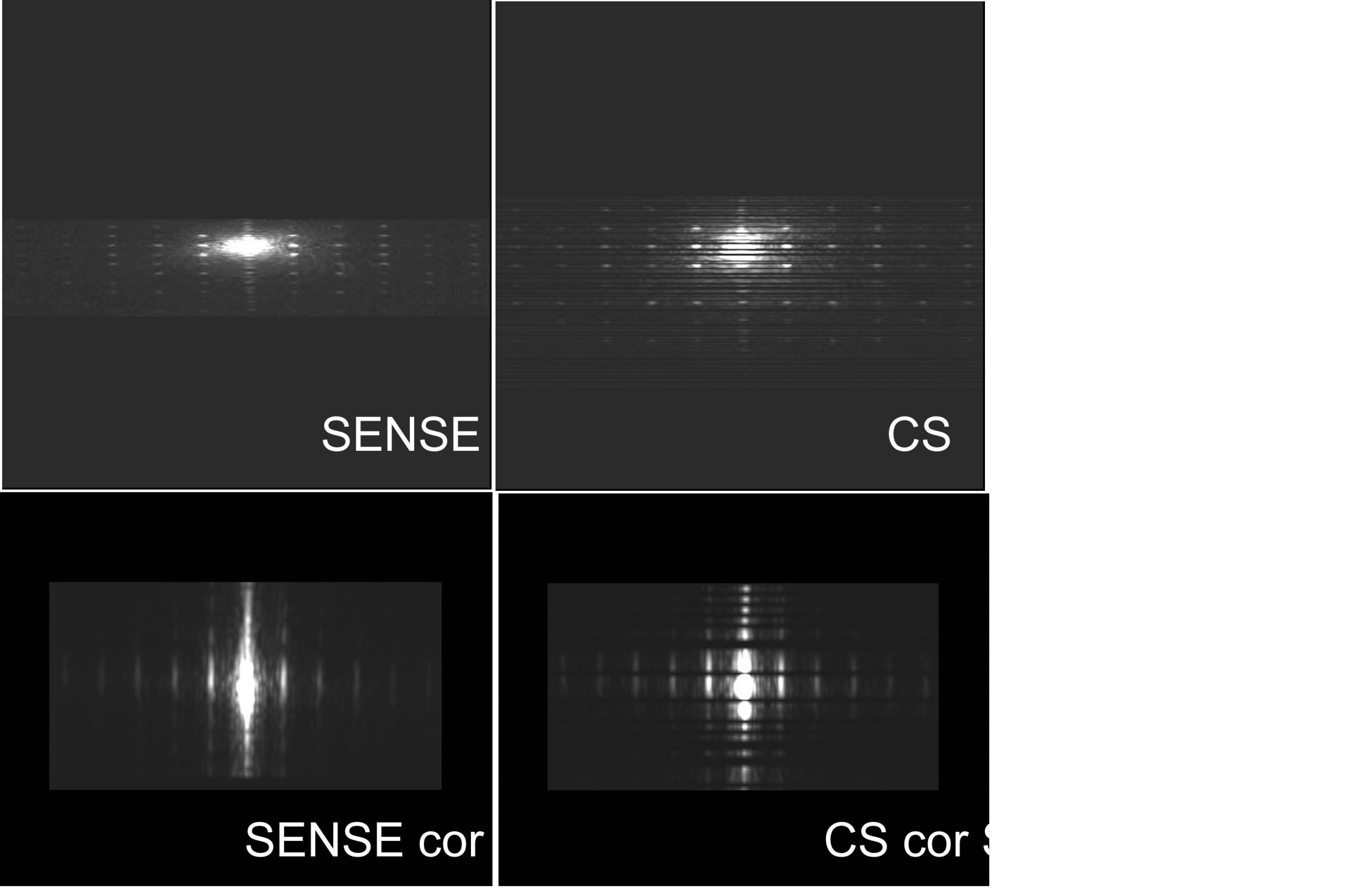 MRI 実験5 腹部ダイナミックSENSEとCSの比較 | tsuyoshi-oshita.com