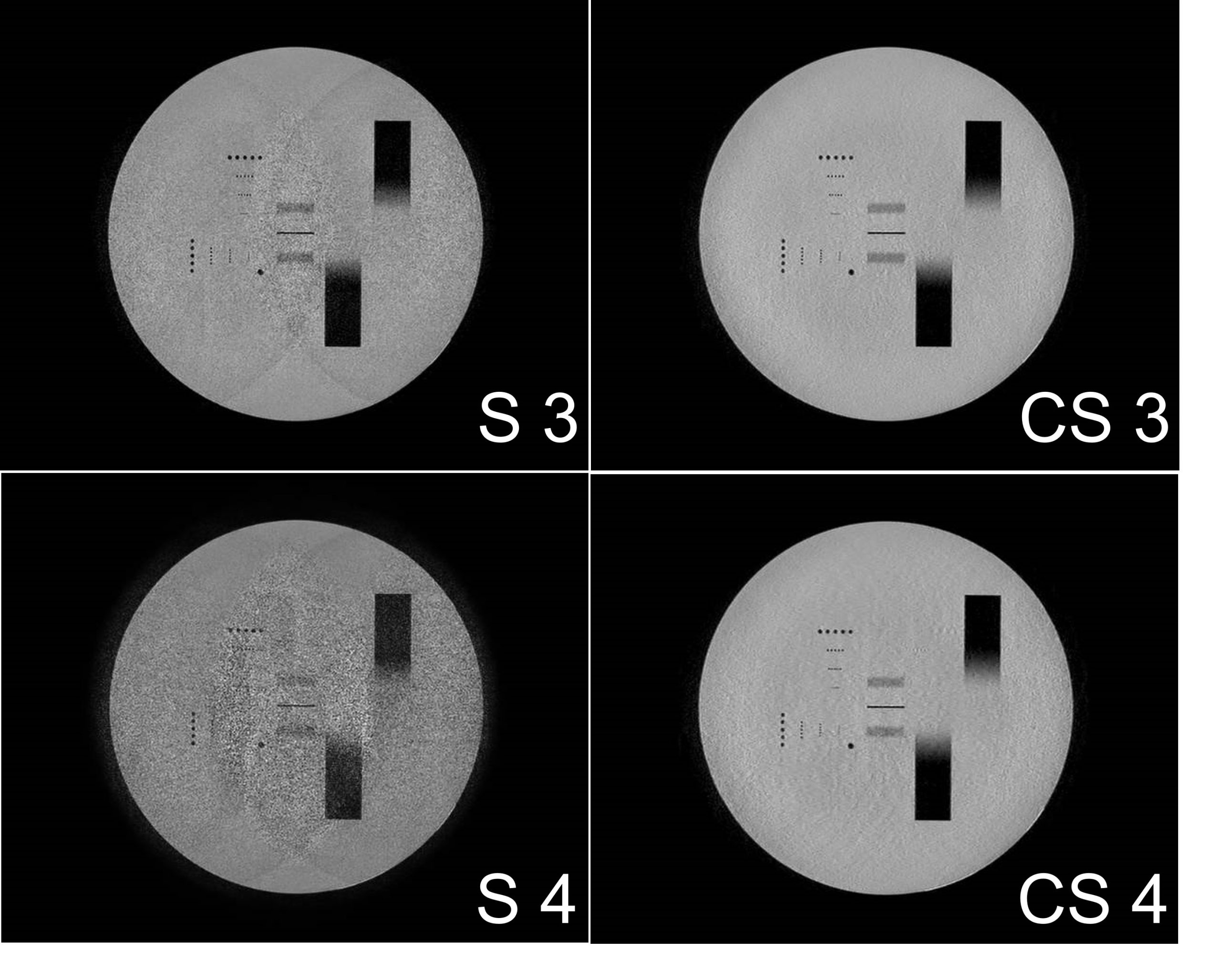 MRI 実験 3 SENSEとCSの比較 | tsuyoshi-oshita.com